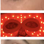 Solawave - Eye Recovery Pro Red Light Therapy Mask | Ulta Beauty